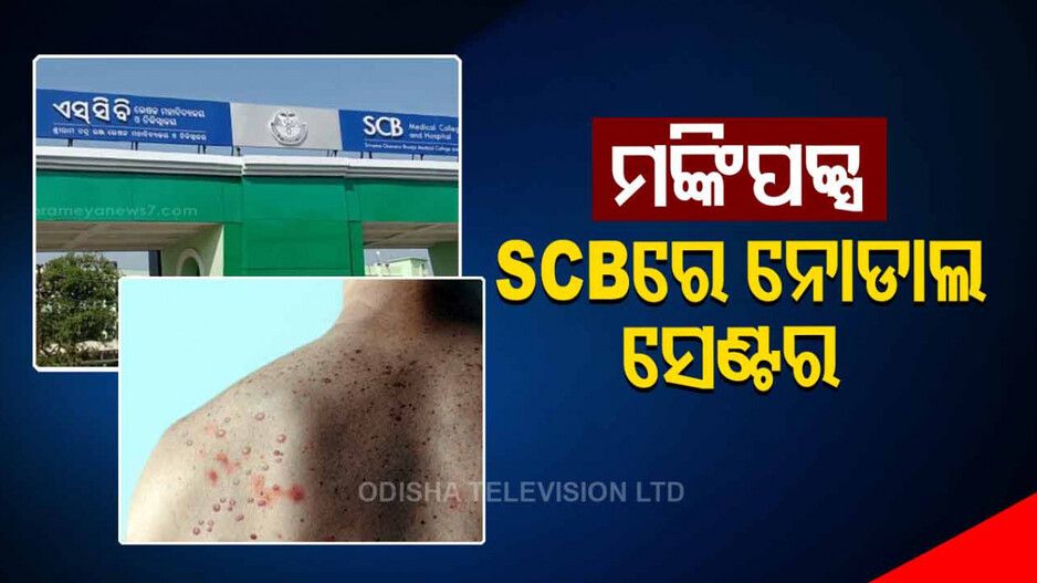 ଏଣିକି SCB ଯିବେ ମଙ୍କିପକ୍ସ ରୋଗୀ: ଖୋଲିଲା ନୋଡାଲ ସେଣ୍ଟର