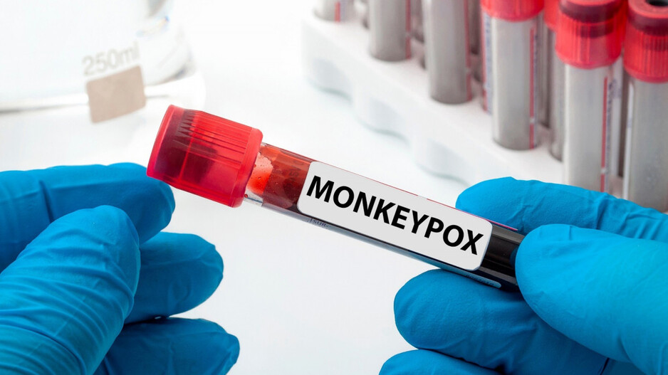 Kerala Alert: Two New Mpox Cases Confirmed