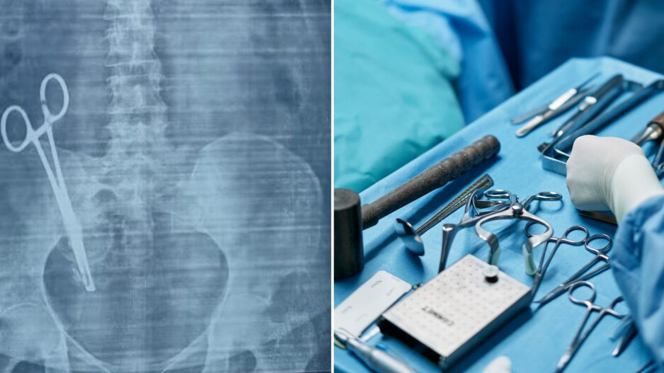 Gross medical negligence: Scissors left in woman’s stomach detected ...